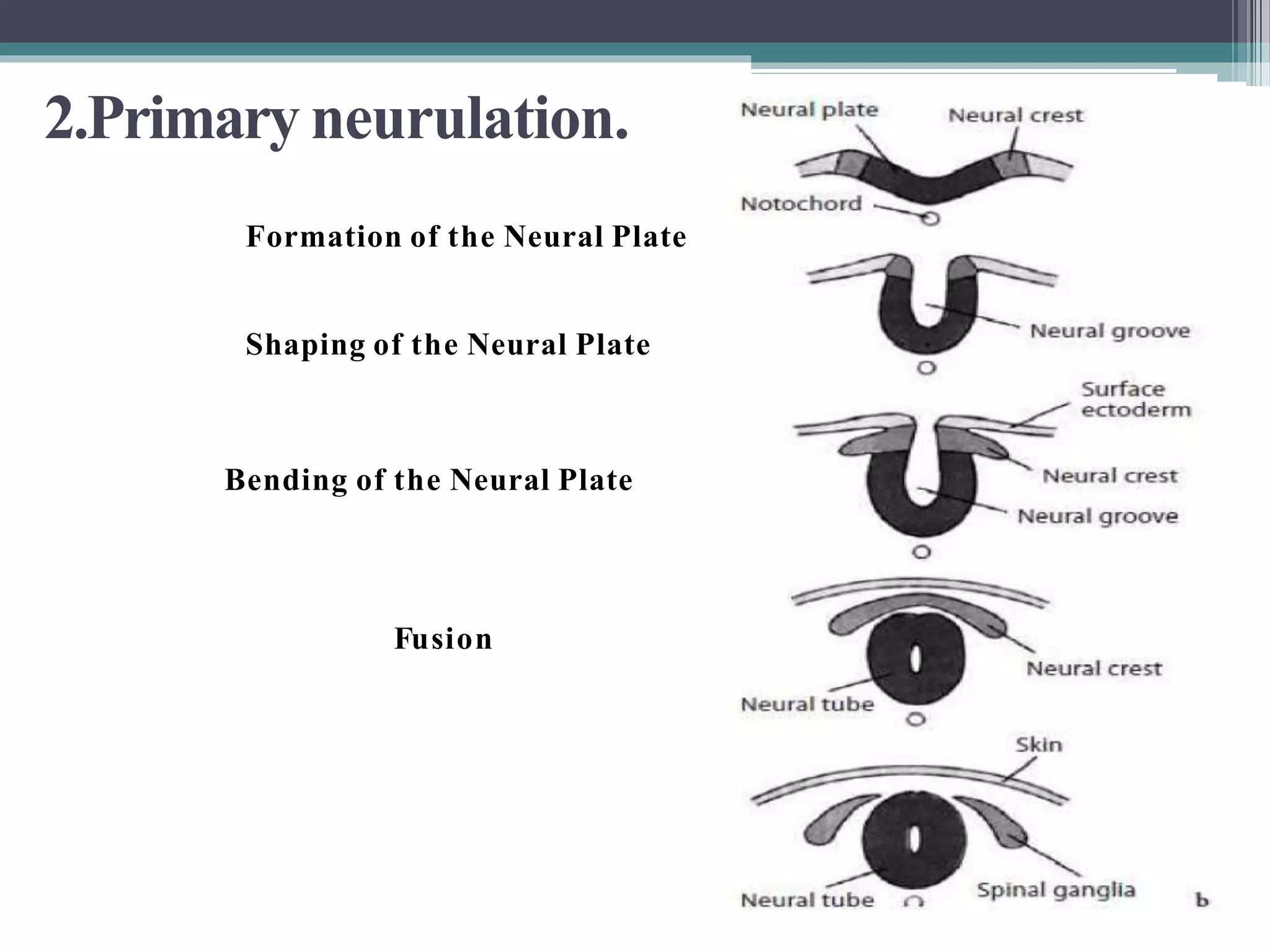 Imaging in spinal dysraphism | PPTX