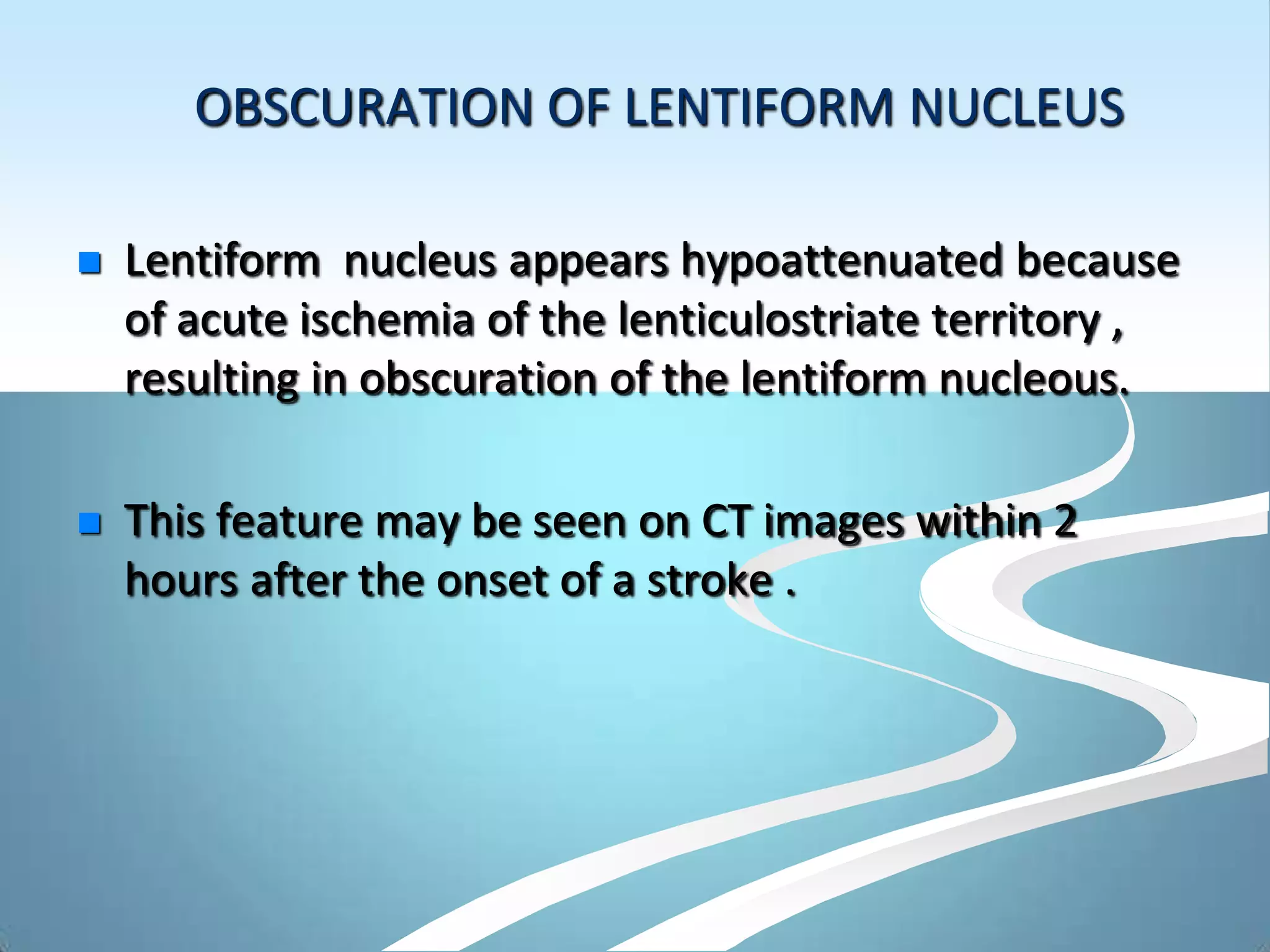 Imaging in stroke | PPTX