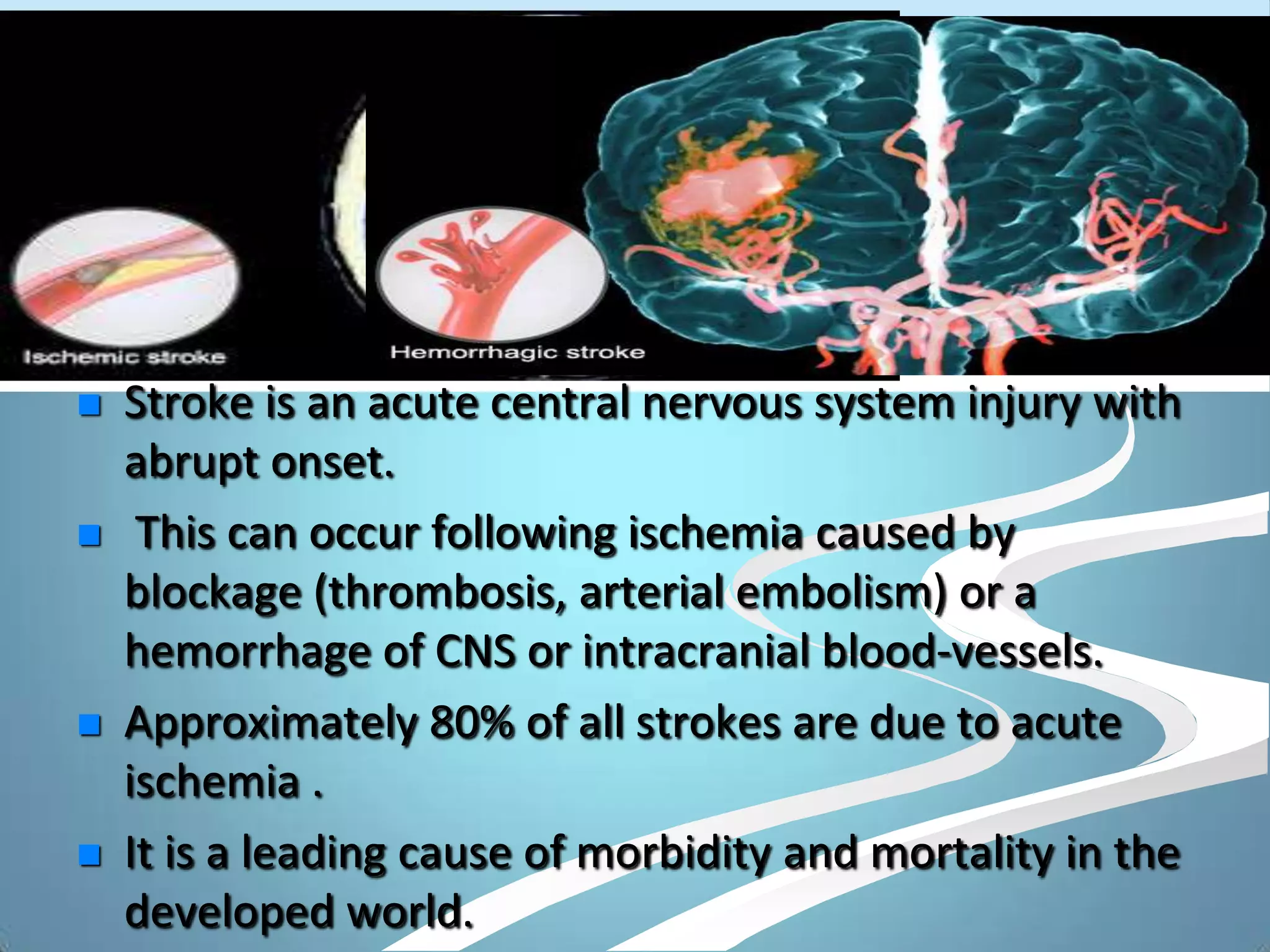 Imaging in stroke | PPTX