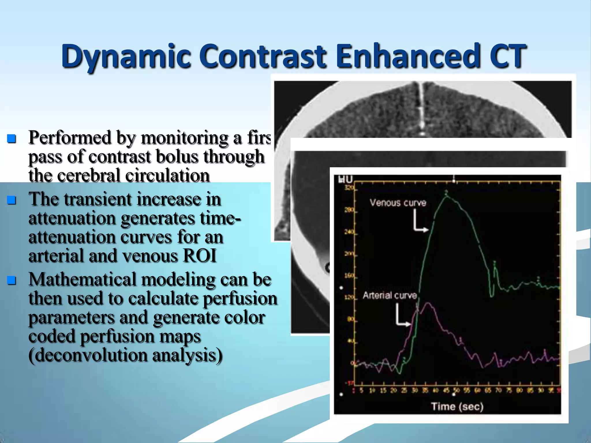 Imaging in stroke | PPTX