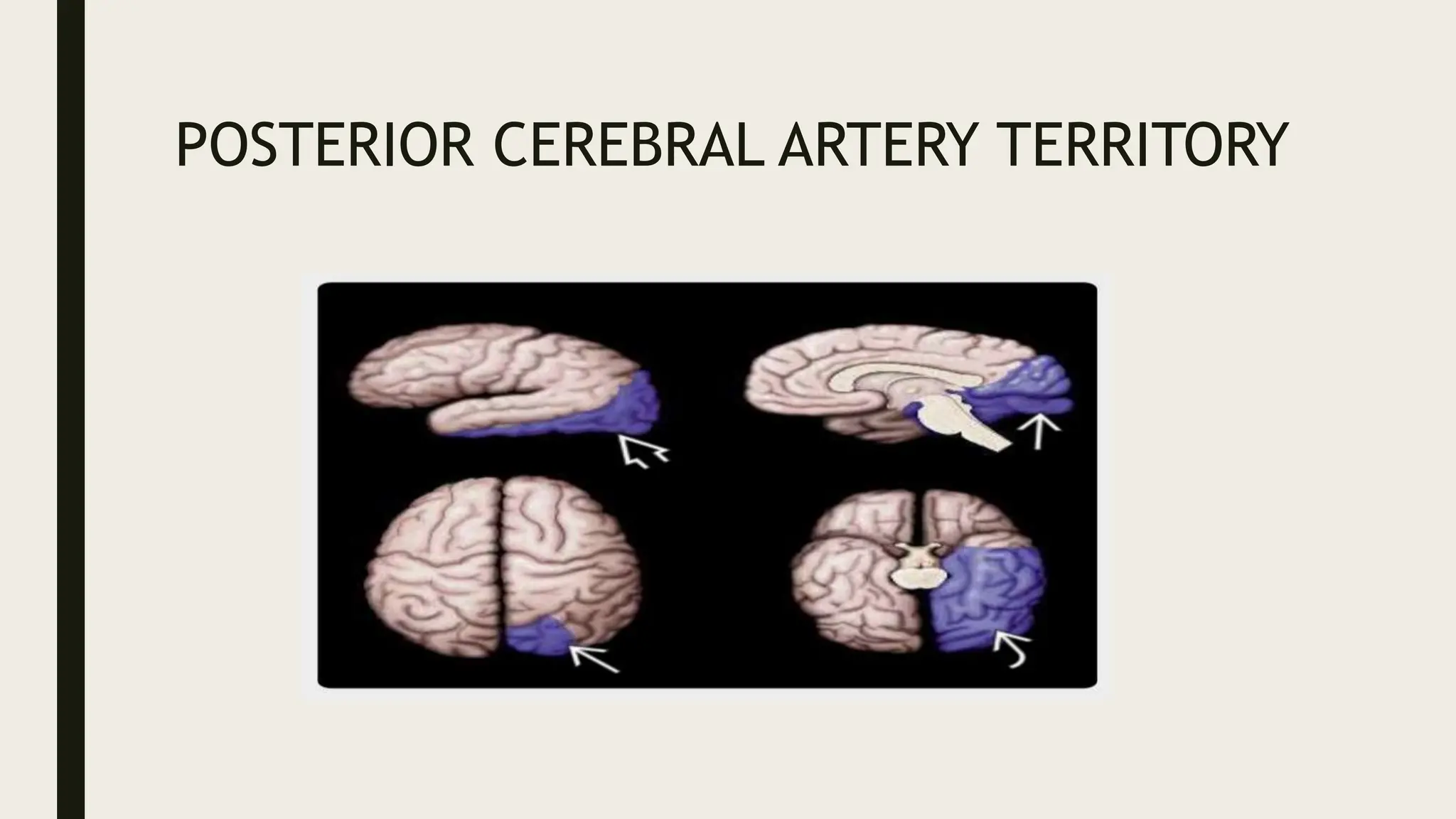 IMAGING IN STROKE.pptxIMAGING IN STROKE.pptx