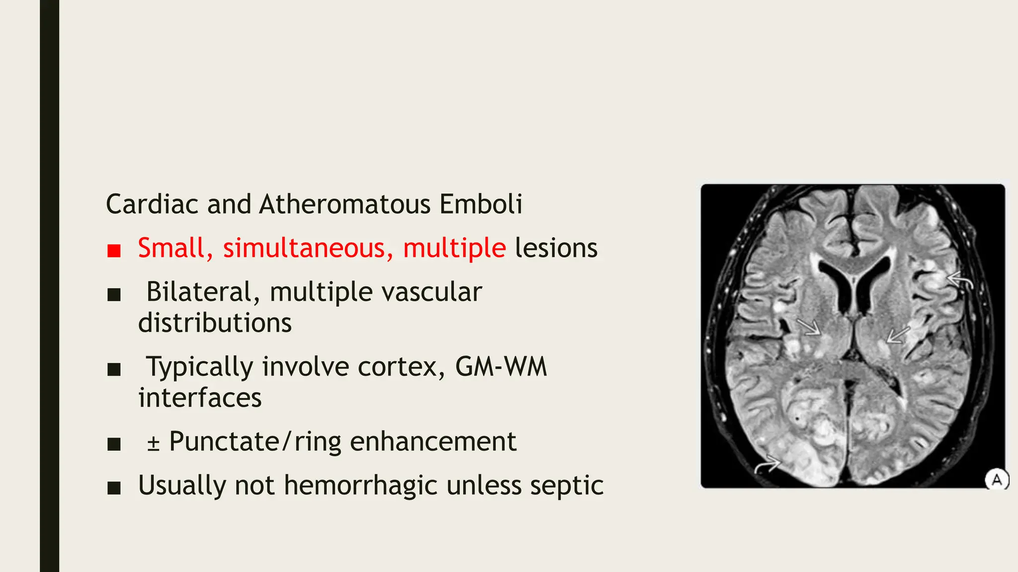 IMAGING IN STROKE.pptxIMAGING IN STROKE.pptx