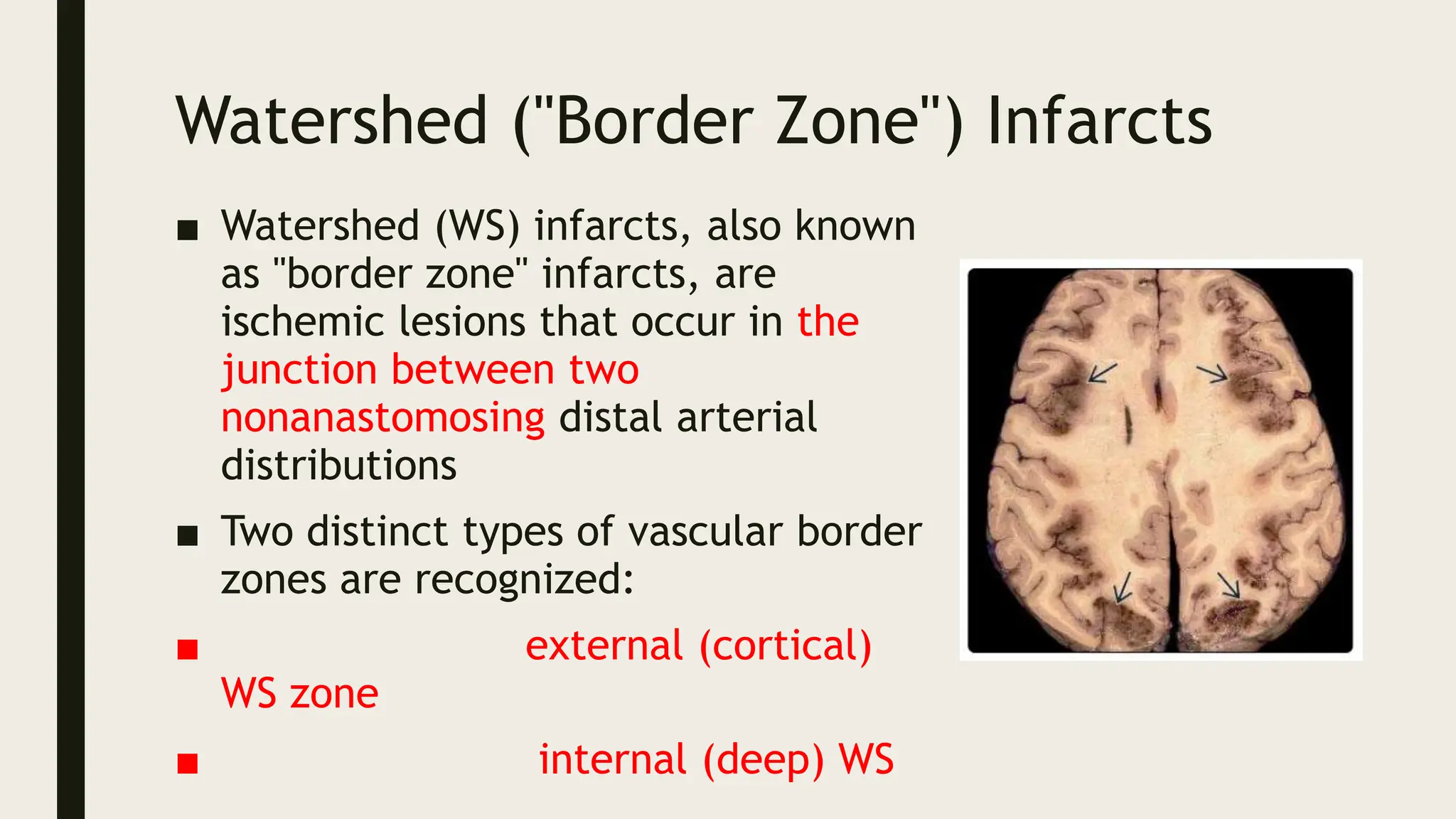 IMAGING IN STROKE.pptxIMAGING IN STROKE.pptx
