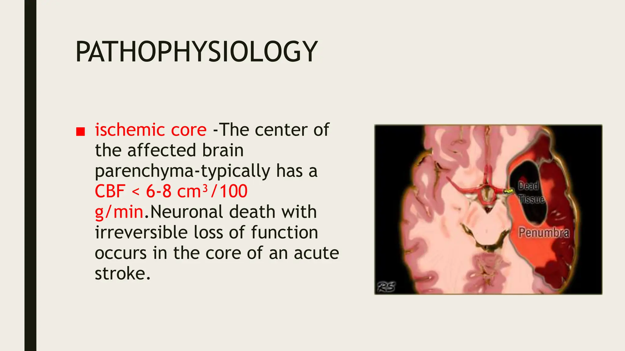 IMAGING IN STROKE.pptxIMAGING IN STROKE.pptx