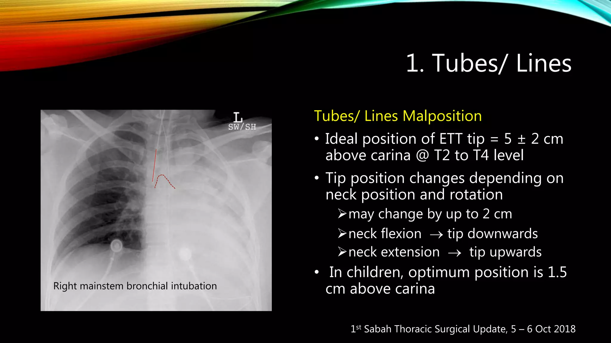 Imaging in Thoracic Trauma | PPTX