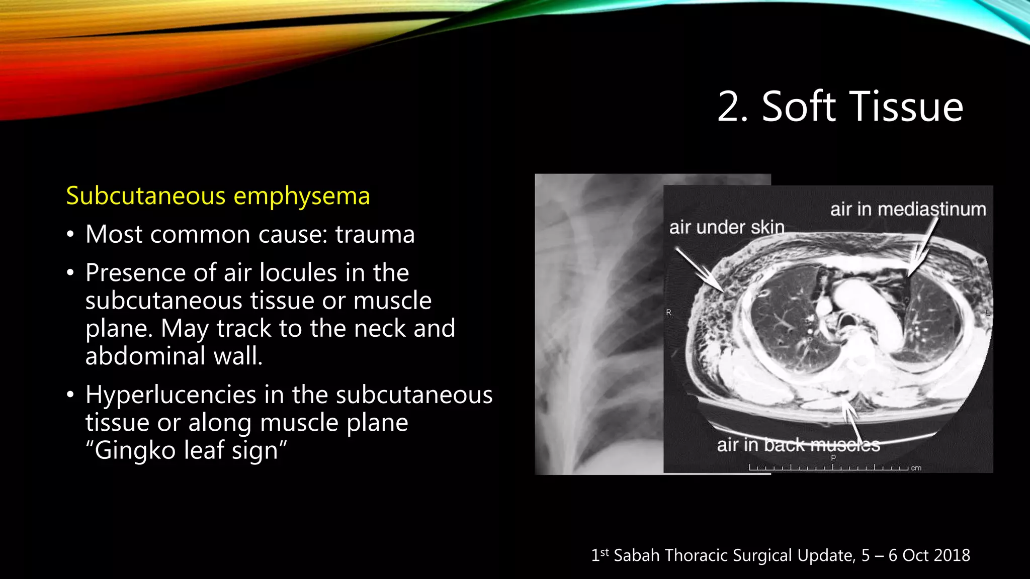 Imaging in Thoracic Trauma | PPTX