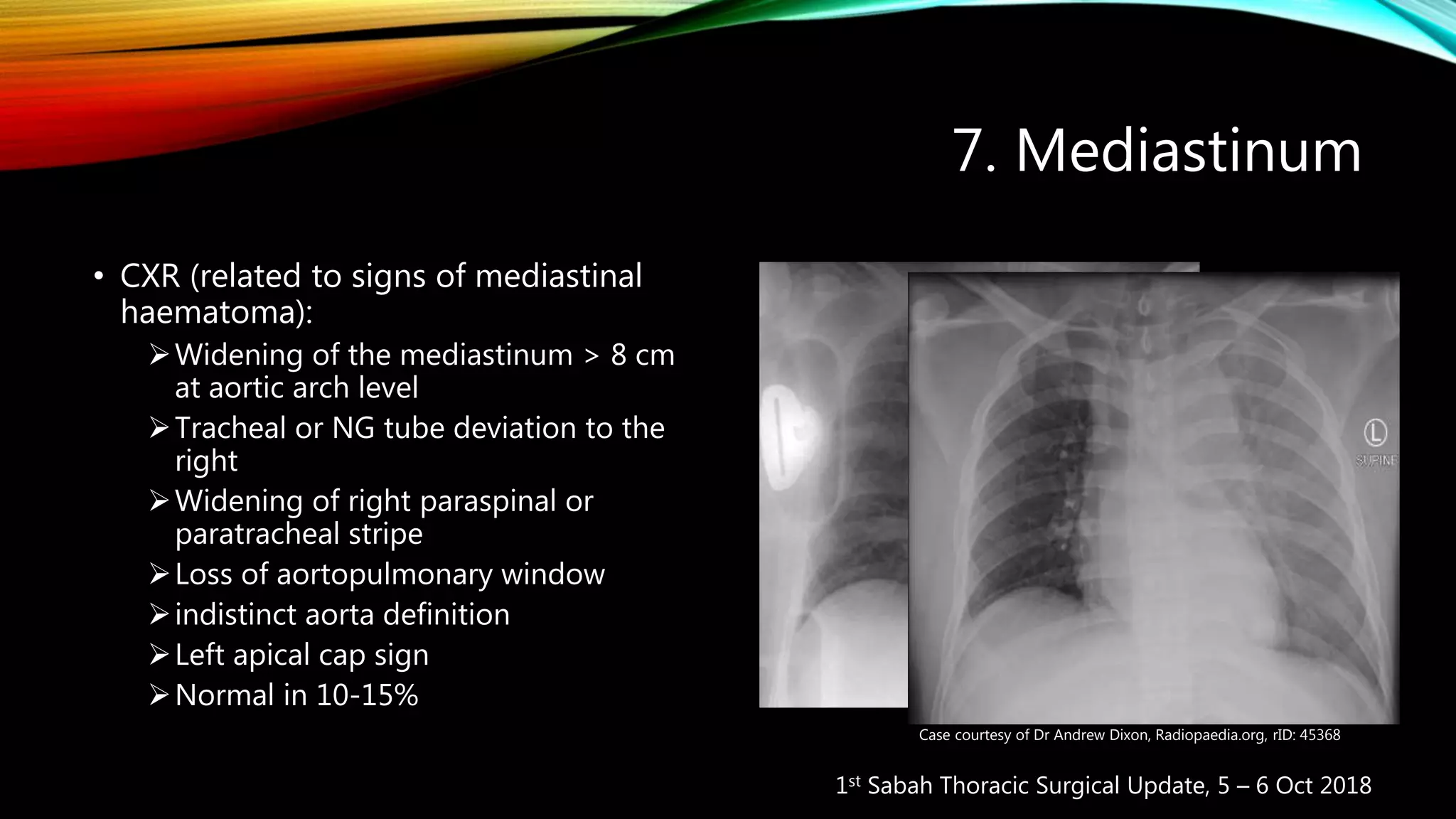 Imaging in Thoracic Trauma | PPTX