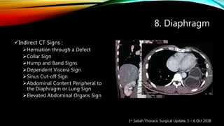 Imaging in Thoracic Trauma | PPTX