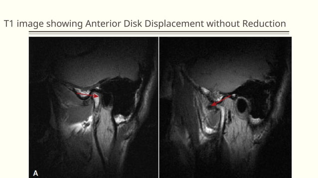 Imaging Modalities in Temporomandibular Joint.pptx