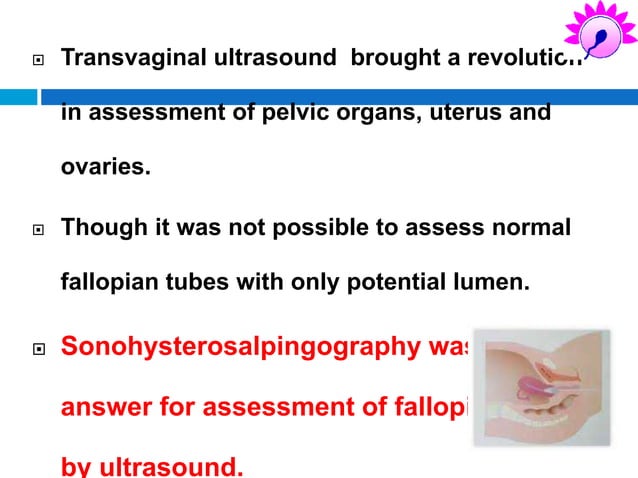 Imaging in tubal factors in infertility. | PPT Imaging in tubal factors in infertility. | PPT