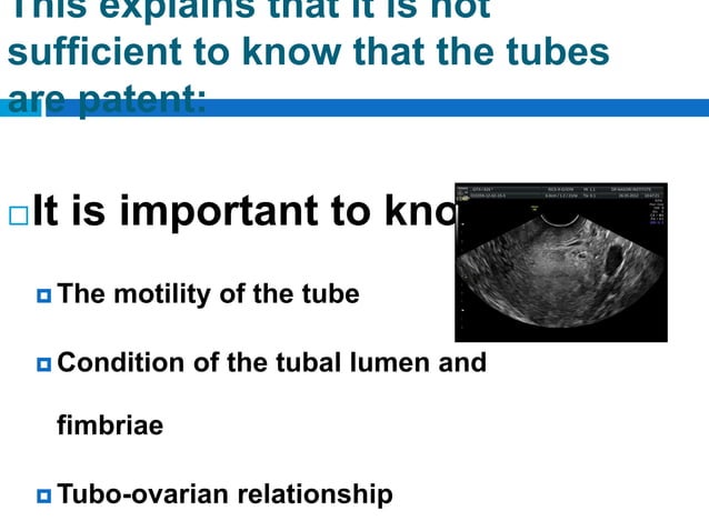 Imaging in tubal factors in infertility. | PPT Imaging in tubal factors in infertility. | PPT
