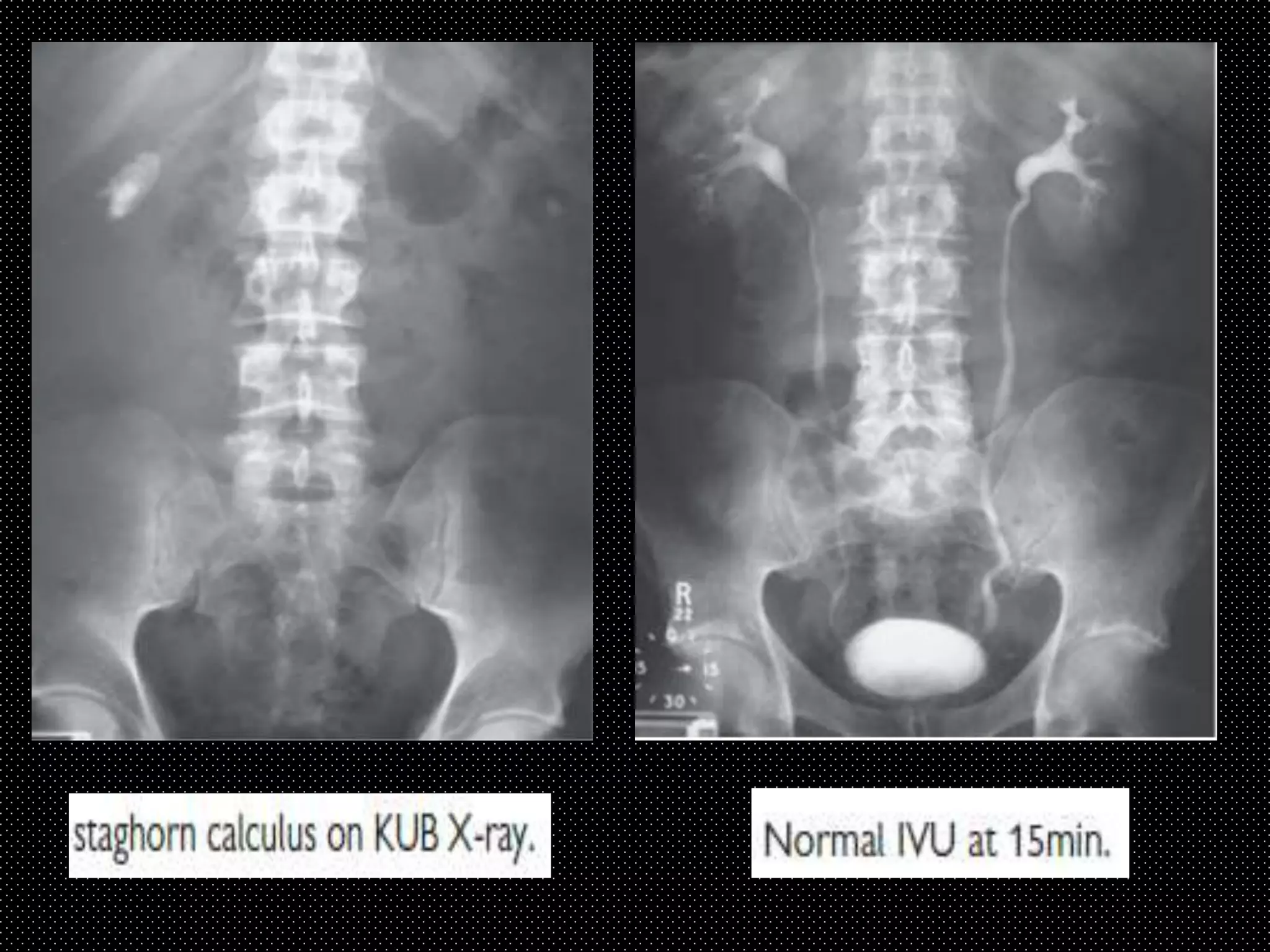 Imaging in urology | PPTX