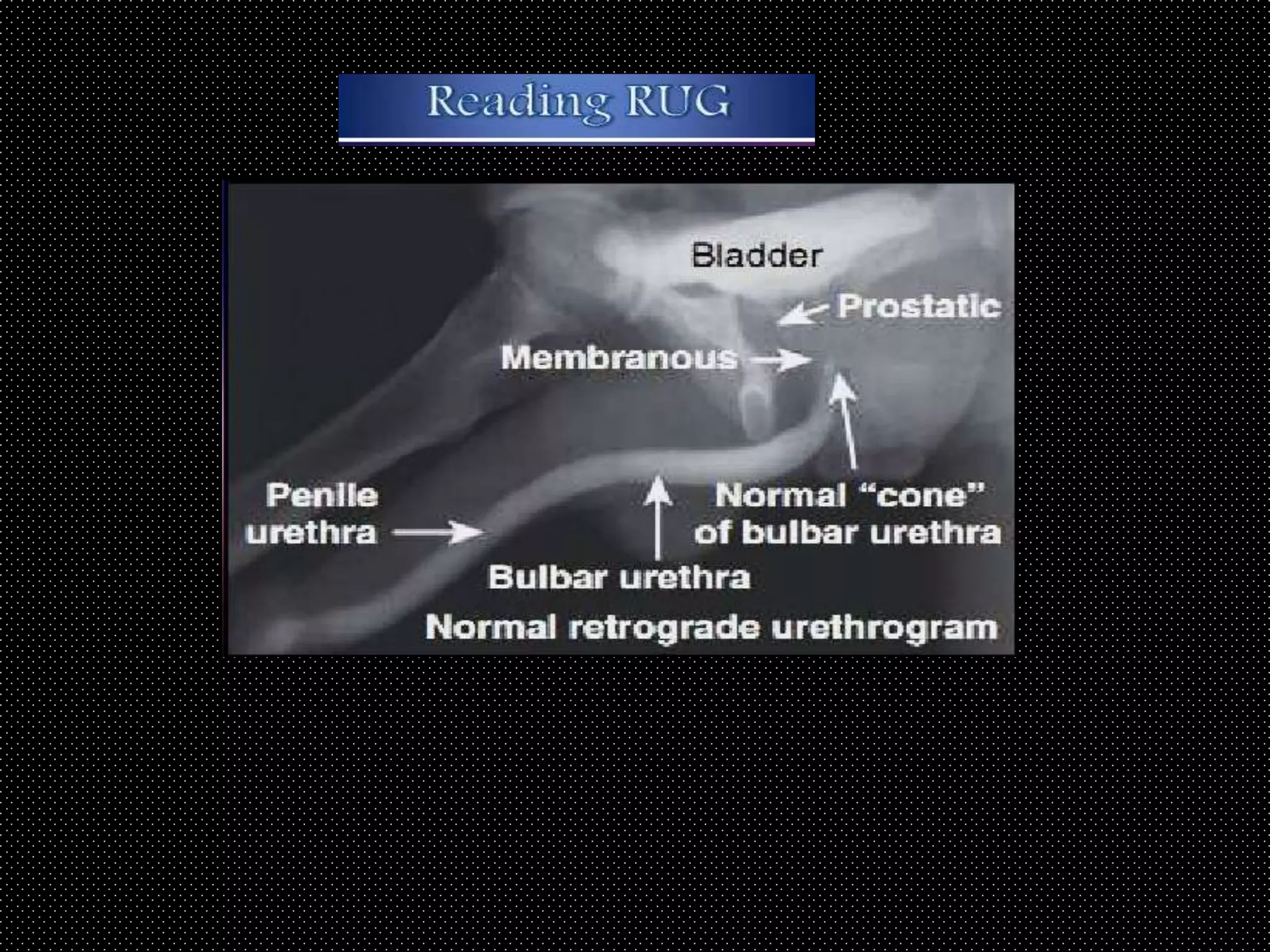 Imaging in urology | PPTX