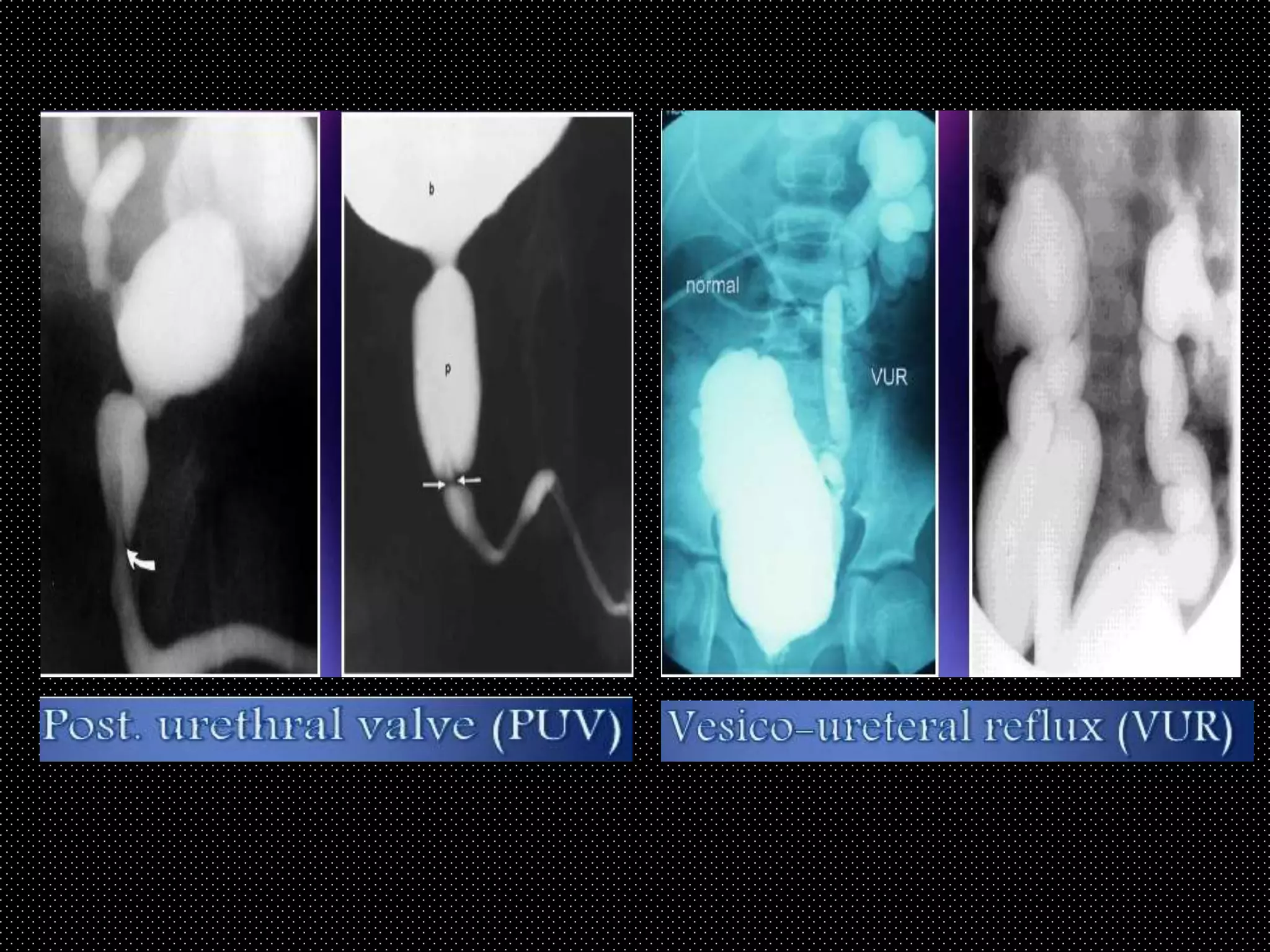 Imaging in urology | PPTX