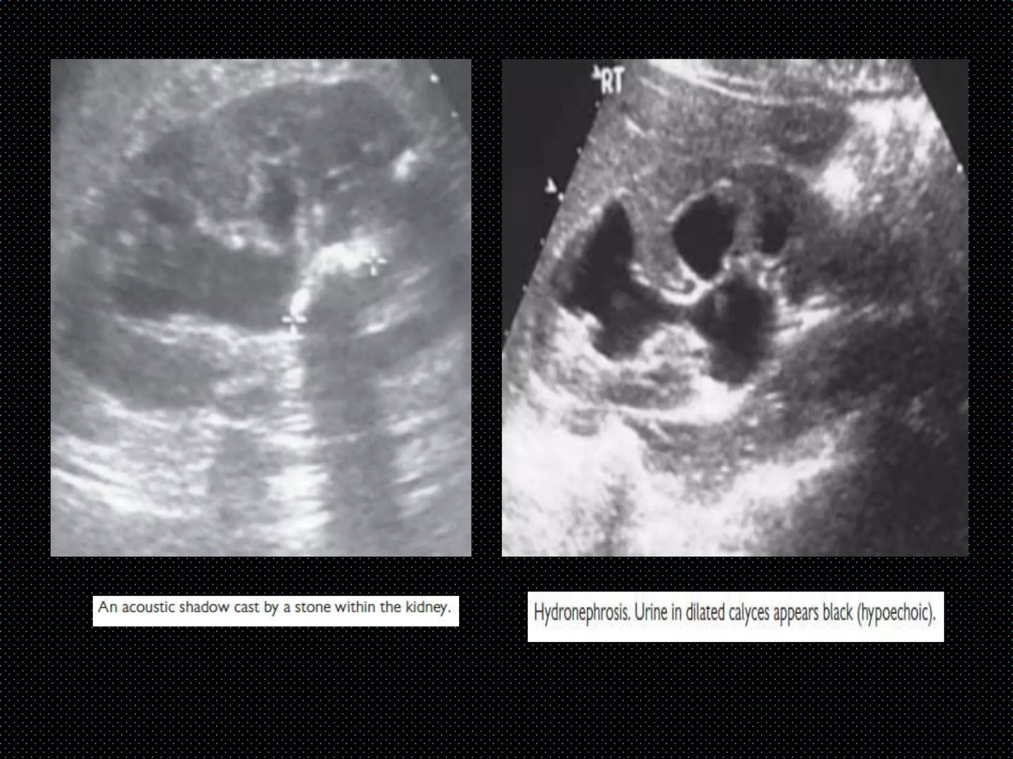 Imaging in urology | PPTX