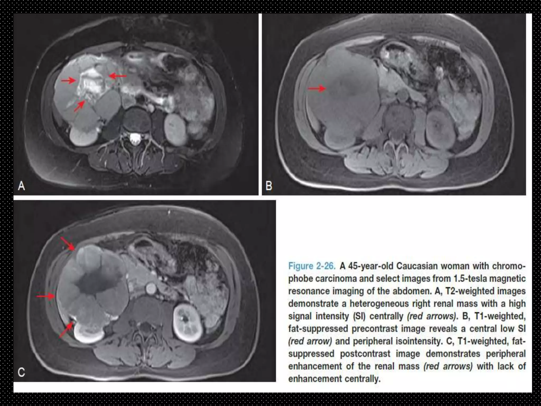 Imaging in urology | PPTX