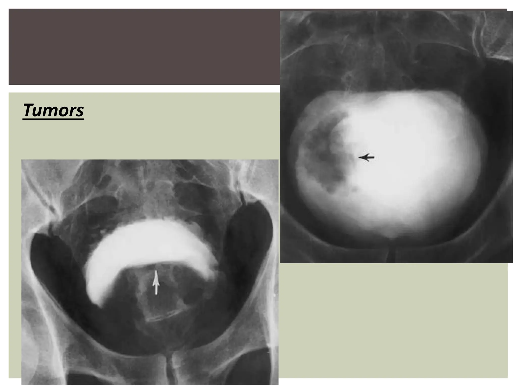 Imaging in urology for MBBS 4th year .pdf