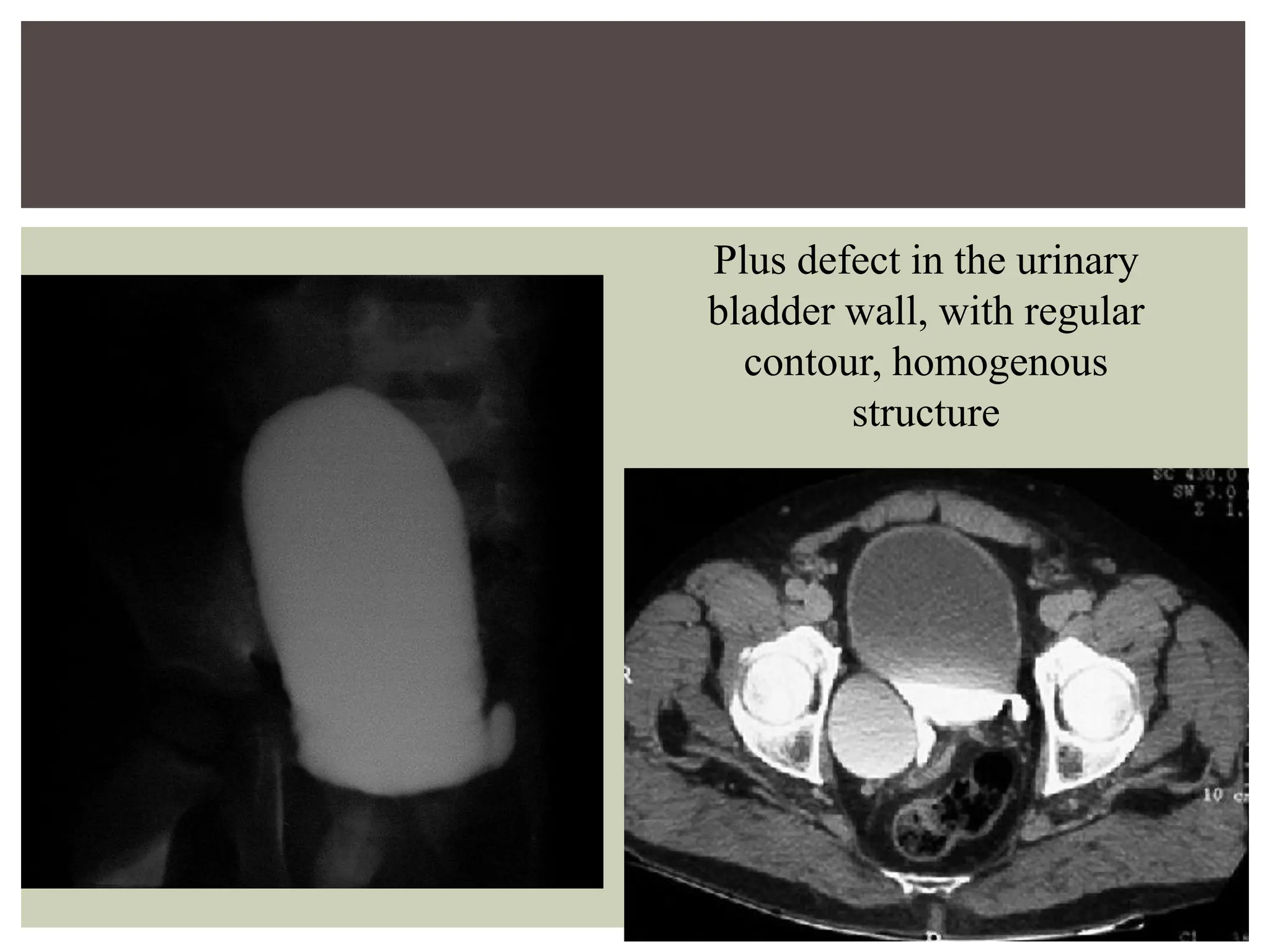 Imaging in urology for MBBS 4th year .pdf
