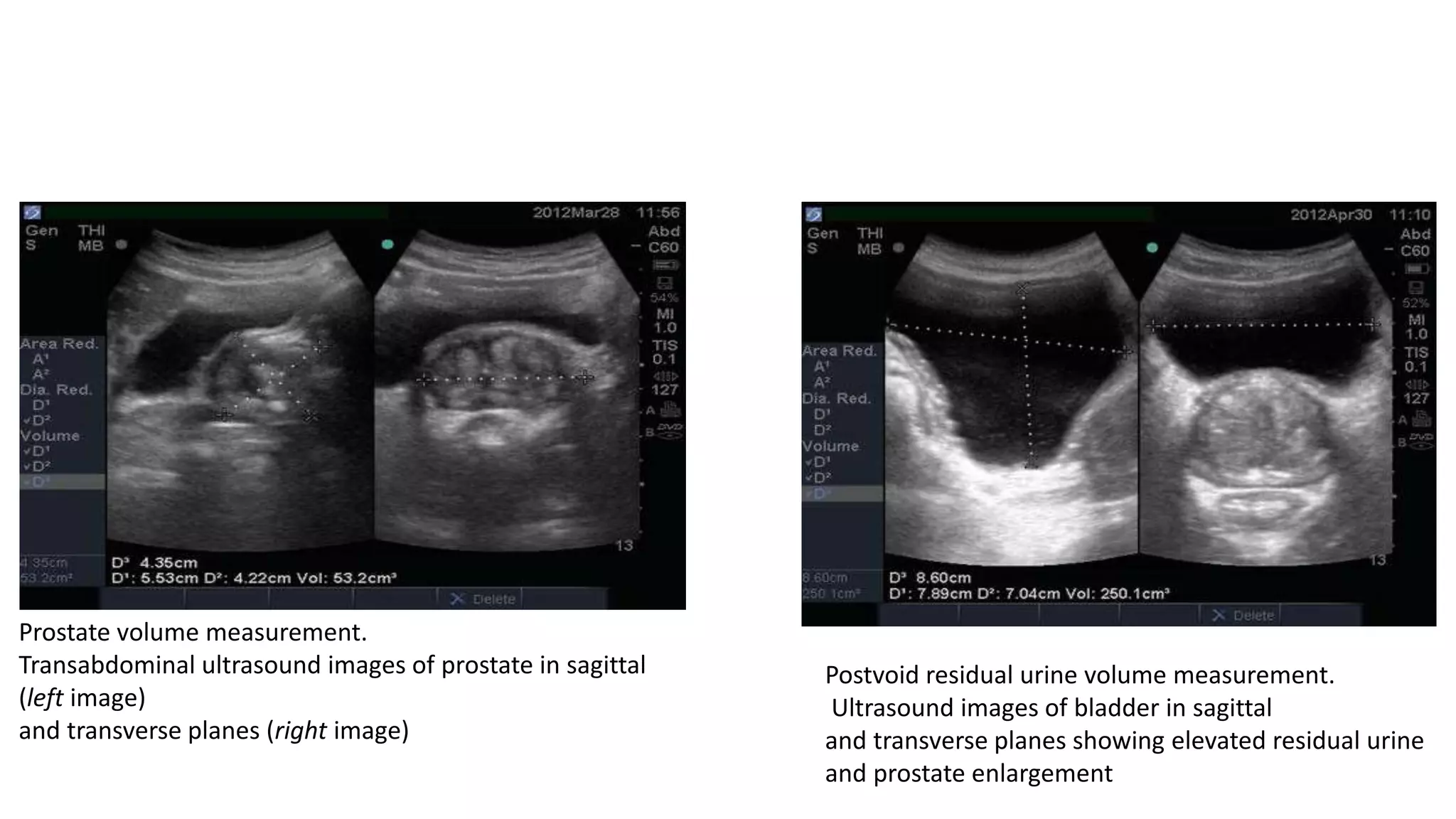 imaging in urology copy.pptx