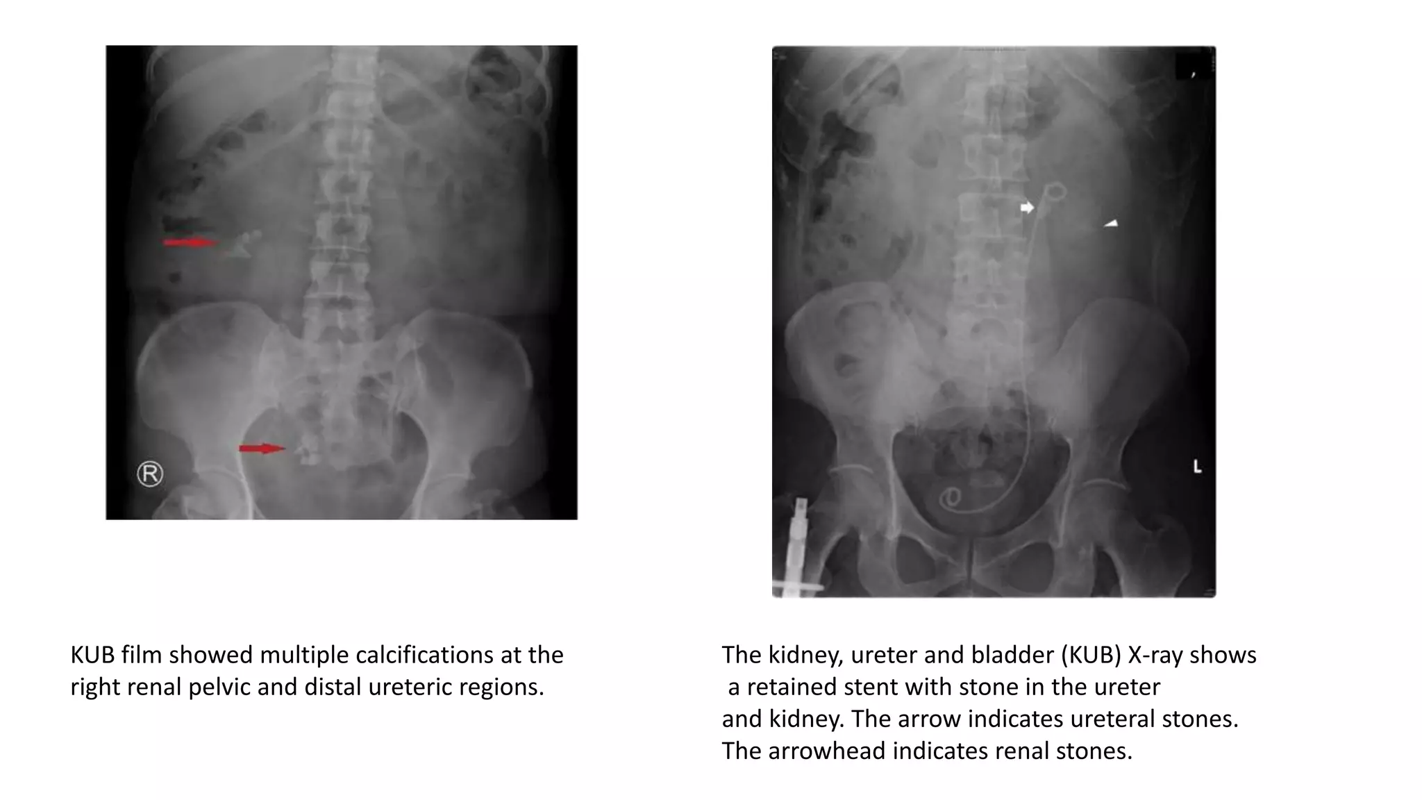 imaging in urology copy.pptx