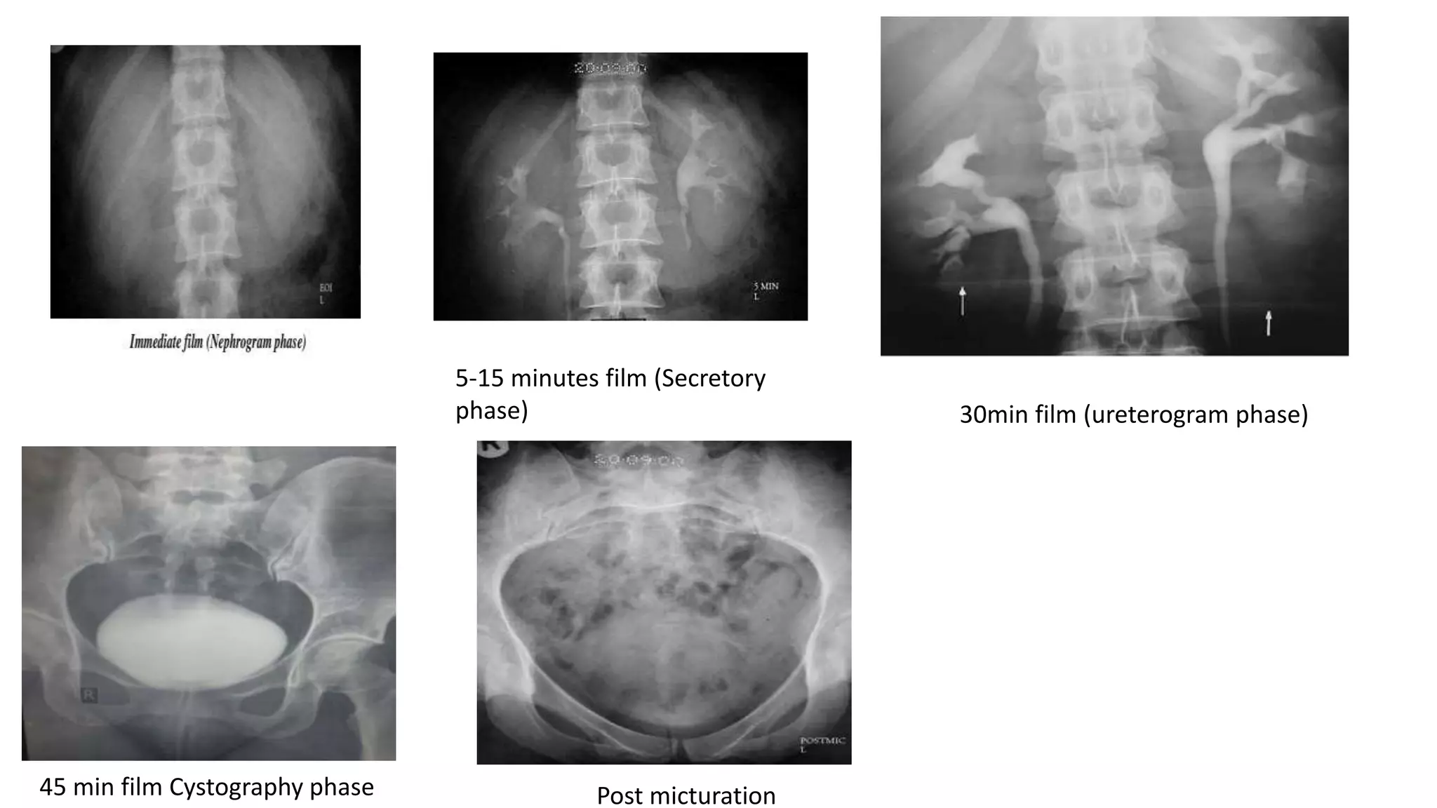 imaging in urology copy.pptx