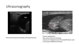 imaging in urology copy.pptx