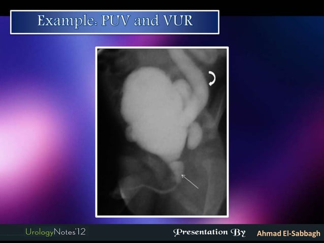 Imaging in urology: part 2 other conventional imaging | PDF
