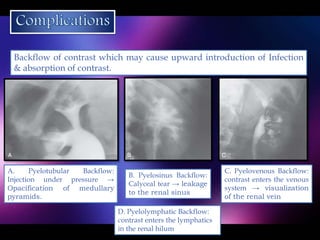 Imaging in urology: part 2 other conventional imaging | PDF