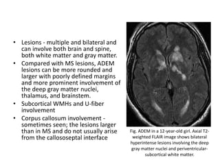 Imaging in white matter disorders gt | PPTX