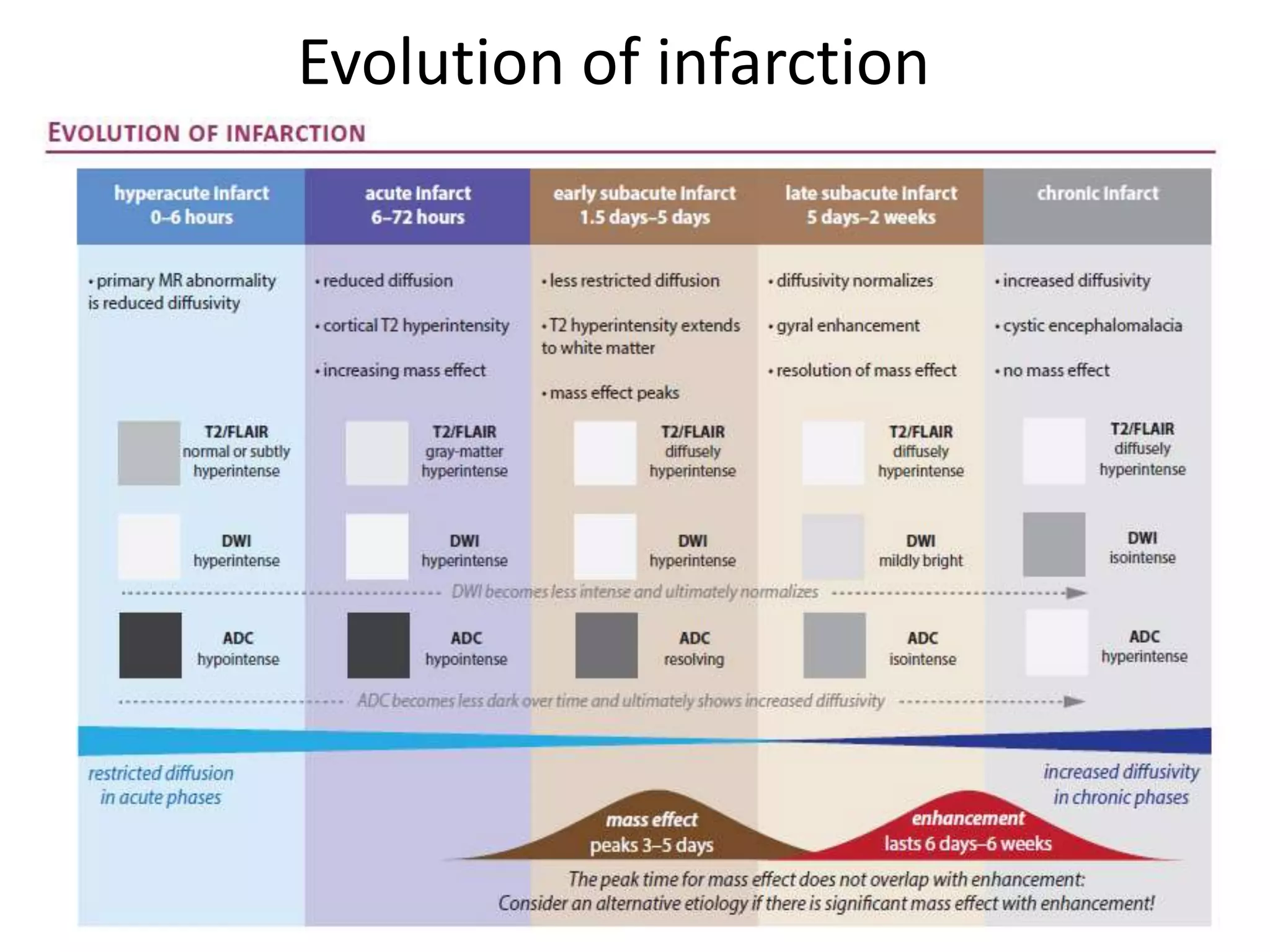 Imaging ischemic infarction.pptx