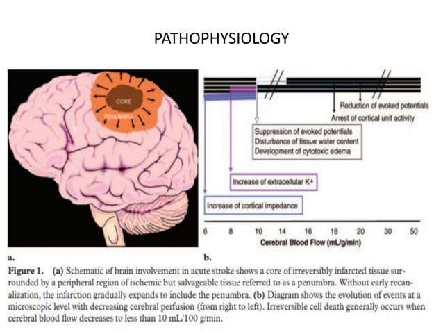Imaging ischemic infarction.pptx