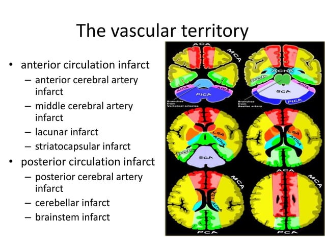 Imaging ischemic infarction.pptx