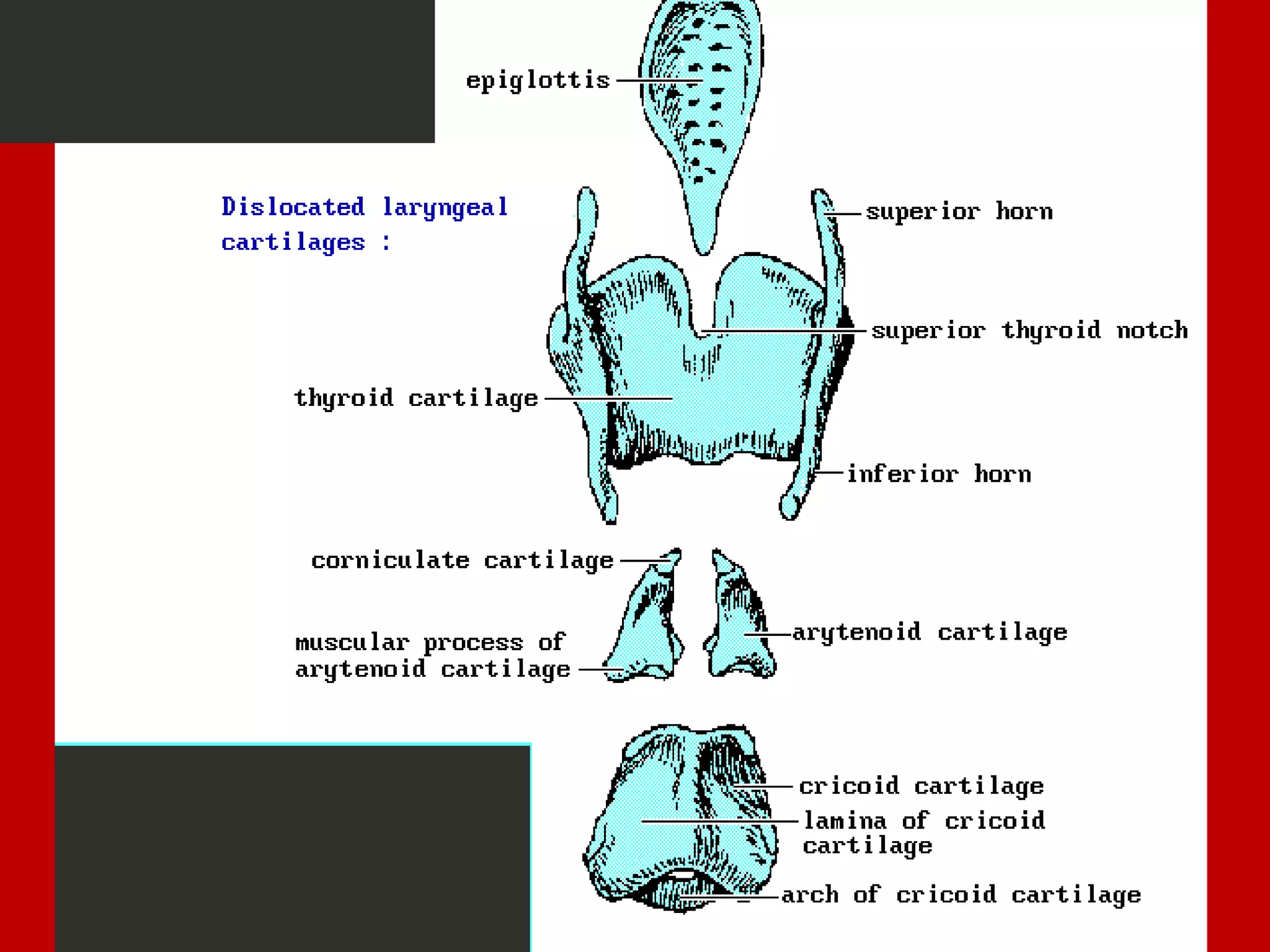 larynx Imaging 1st part laryngeal anatomy CT MRI Dr Ahmed Esawy | PDF