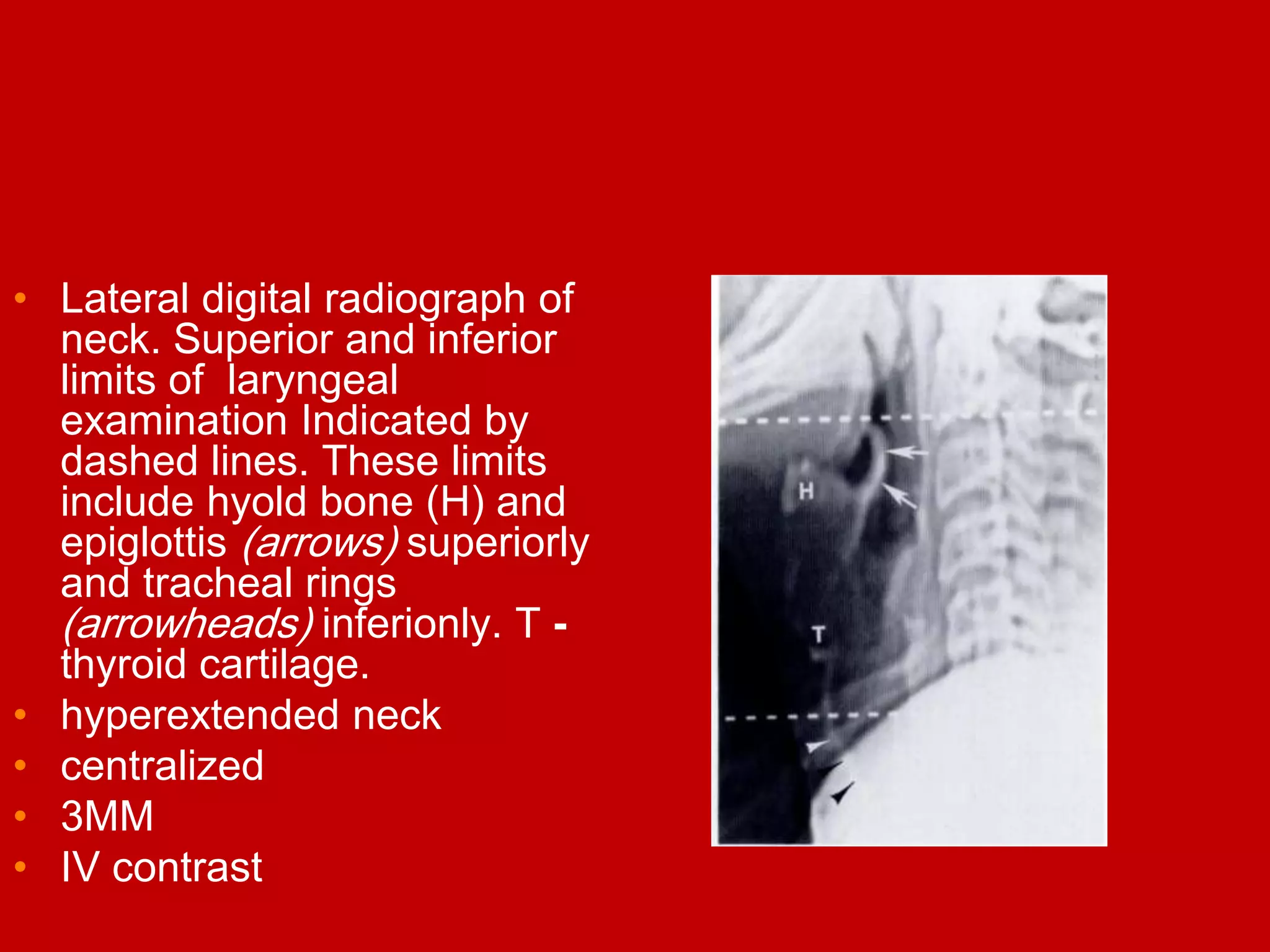 larynx Imaging 1st part laryngeal anatomy CT MRI Dr Ahmed Esawy | PDF