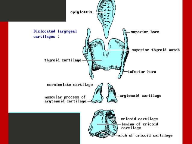 larynx Imaging 1st part laryngeal anatomy CT MRI Dr Ahmed Esawy | PDF