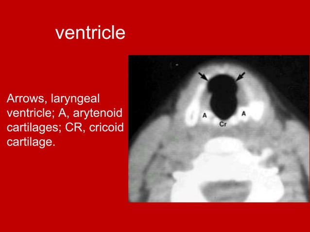 larynx Imaging 1st part laryngeal anatomy CT MRI Dr Ahmed Esawy | PDF