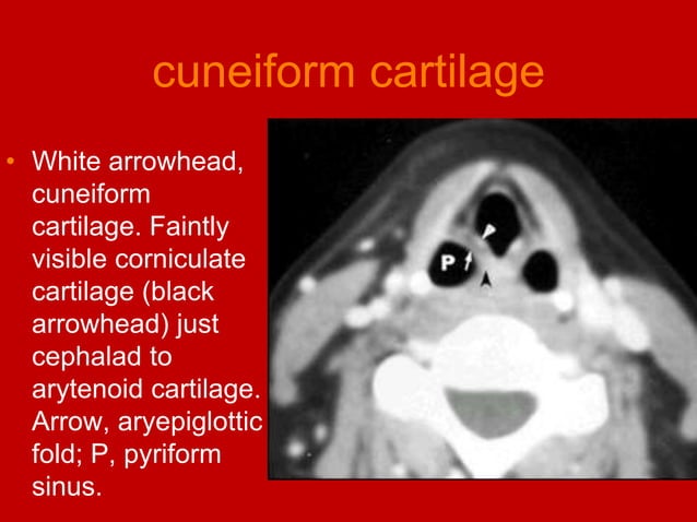 larynx Imaging 1st part laryngeal anatomy CT MRI Dr Ahmed Esawy | PDF