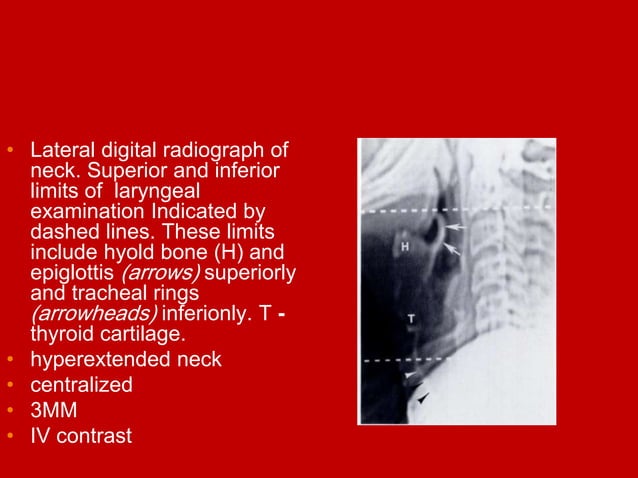 larynx Imaging 1st part laryngeal anatomy CT MRI Dr Ahmed Esawy | PDF