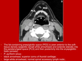 larynx Imaging 1st part laryngeal anatomy CT MRI Dr Ahmed Esawy | PDF