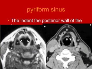 larynx Imaging 1st part laryngeal anatomy CT MRI Dr Ahmed Esawy | PDF