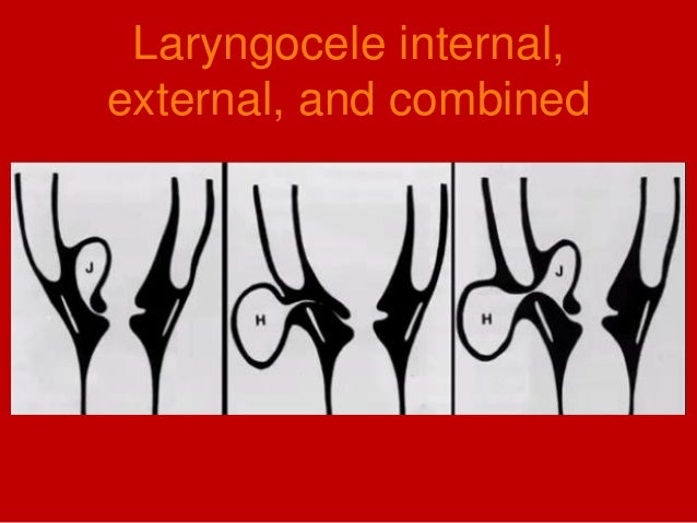 Larynx Imaging 2nd part laryngeal congenital inflammatory traumatic C…