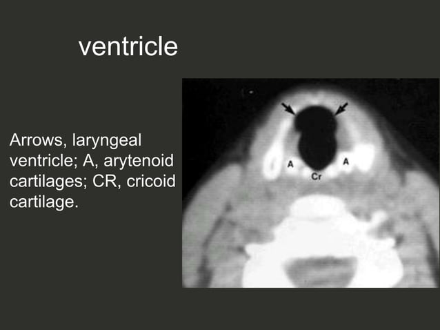 Full Story larynx Imaging CT MRI Dr Ahmed Esawy | PPT