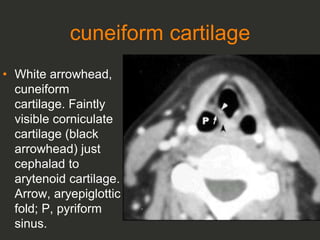 Arytenoid And Corniculate Cartilage