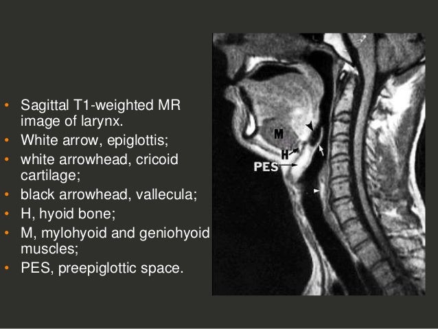 Full Story larynx Imaging CT MRI Dr Ahmed Esawy