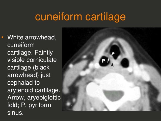 Full Story larynx Imaging CT MRI Dr Ahmed Esawy