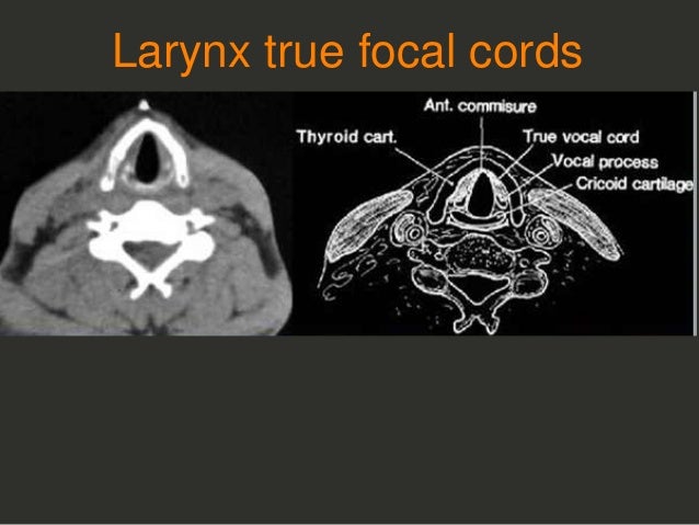 Full Story larynx Imaging CT MRI Dr Ahmed Esawy