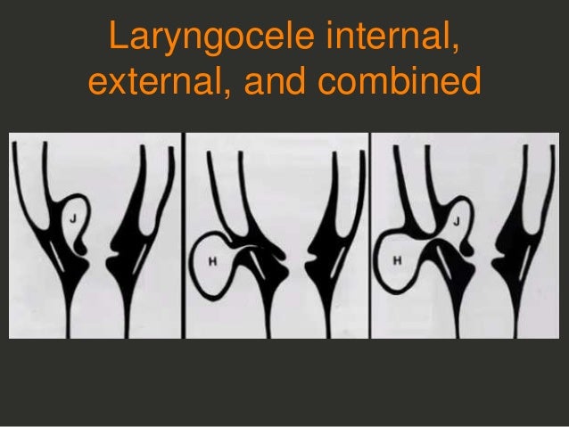Full Story larynx Imaging CT MRI Dr Ahmed Esawy