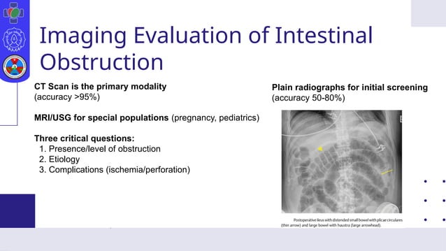 Imaging Modalities for Evaluation of Intestinal Obstruction.pptx