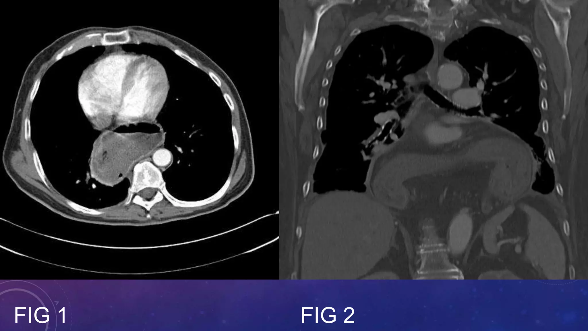 Imaging modalities of diaphragm | PPTX