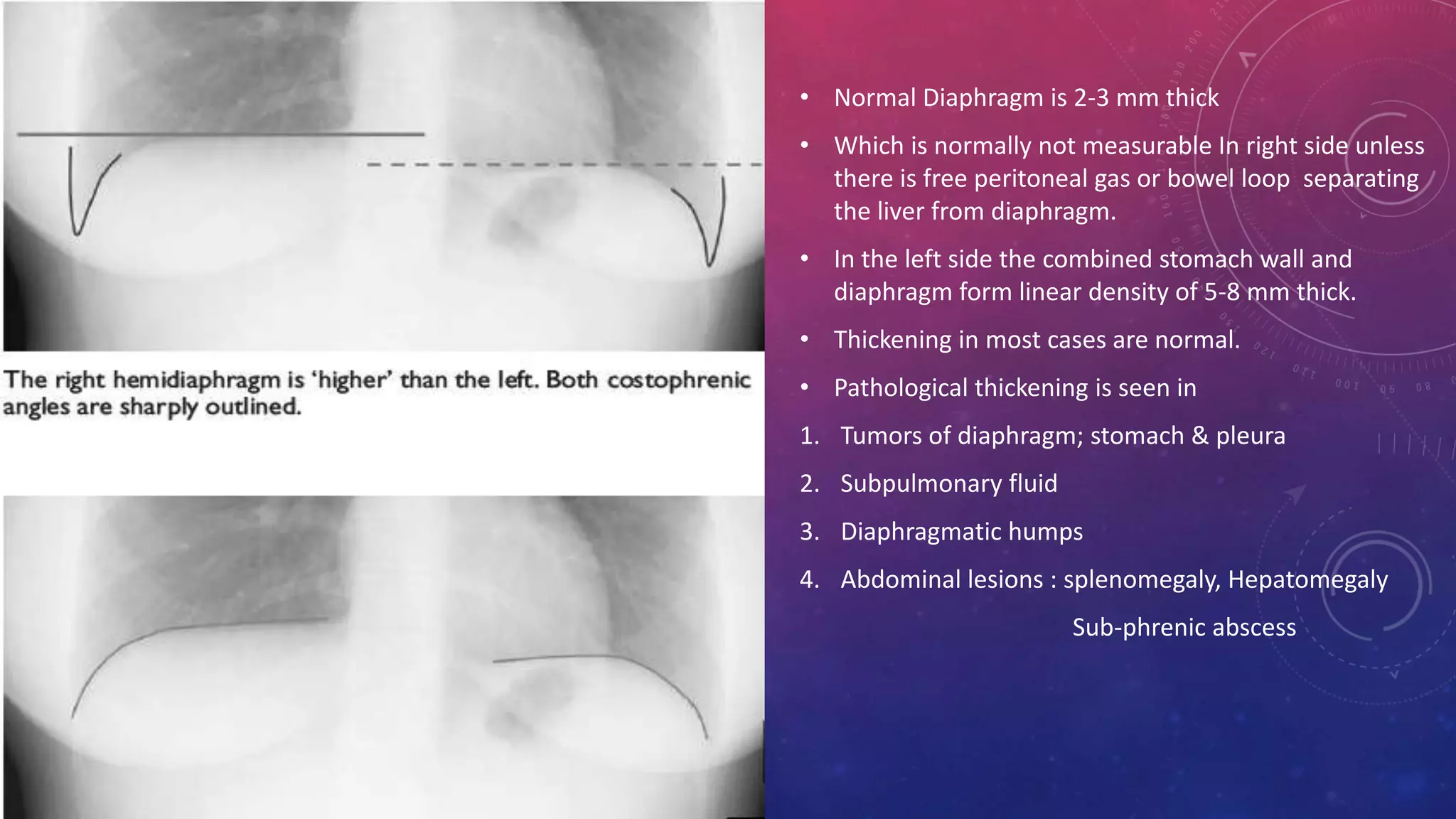 Imaging modalities of diaphragm | PPTX